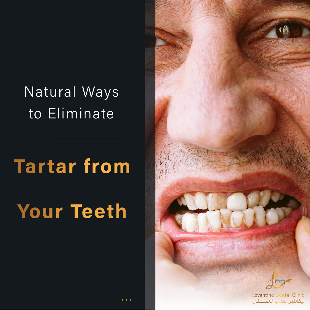 Effective Natural Ways To Eliminate Tartar From Your Teeth