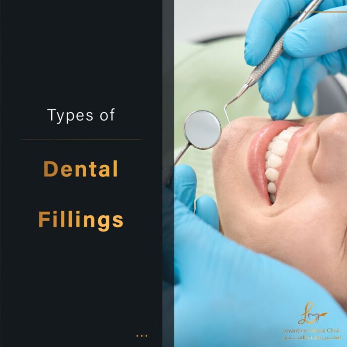 Exploring The Various Types Of Dental Fillings
