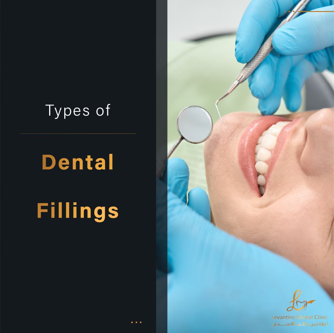 Exploring The Various Types Of Dental Fillings